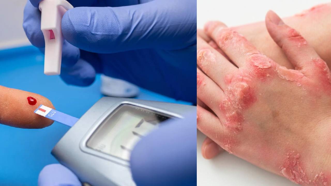 Diabetes Skin Problems: ত্বকই বলে দেবে ডায়াবেটিসের কথা, বুঝবেন কীভাবে ...